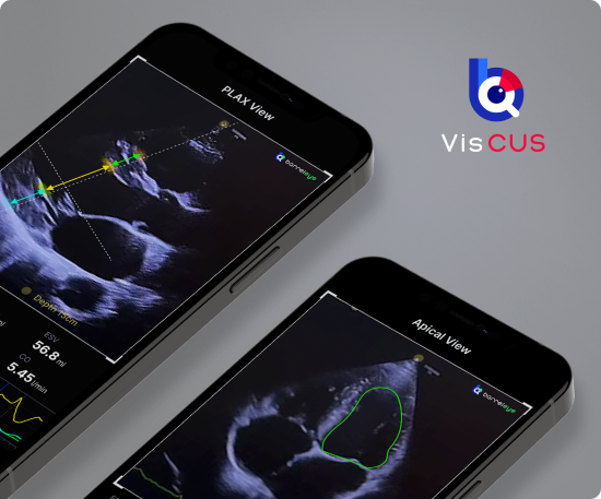 Vis-CUS - Echocardiography Myocardial Function Assessment AI Solution