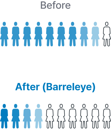 Int-BUS - Breast Ultrasound Cancer Diagnosis AI Solution